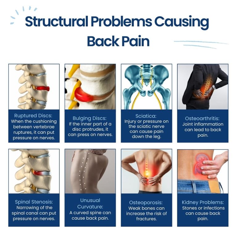 What Is Causing My Back Pain, and How Can I Remedy It? | Pain Physicians NY