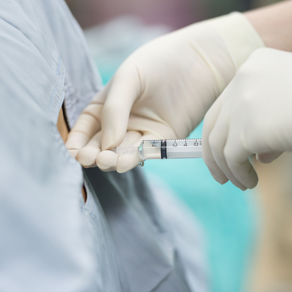 Cervical Epidural Steroid Injections (Back Pain Specialists) Brooklyn